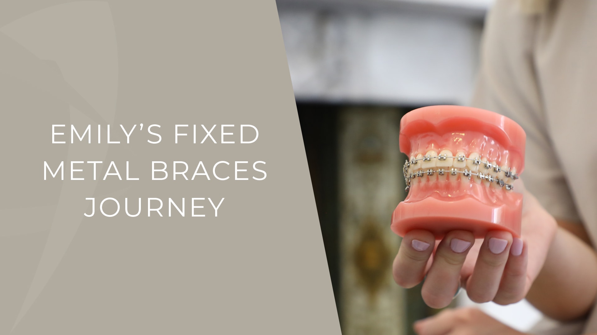 Emily's Fixed Metal Braces Journey - London Dental Specialists