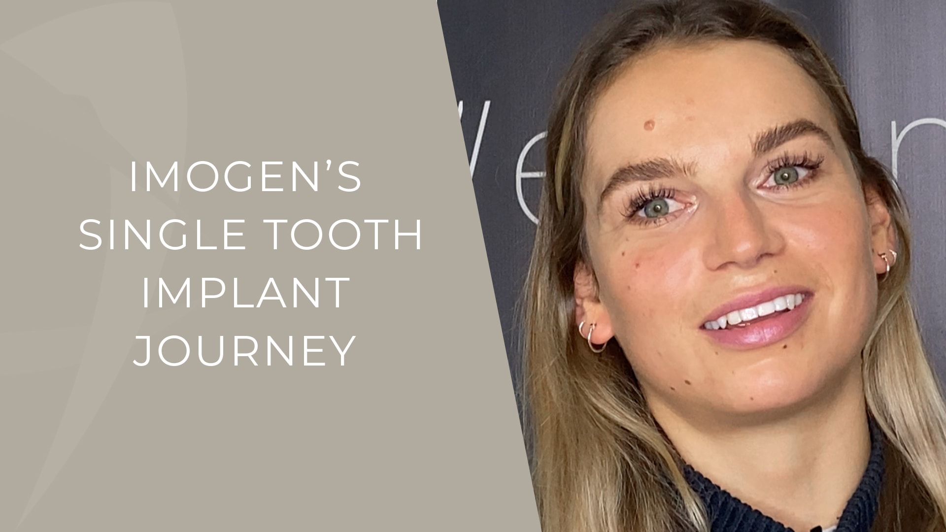 Imogen's Dental Implant Journey - London Dental Specialists