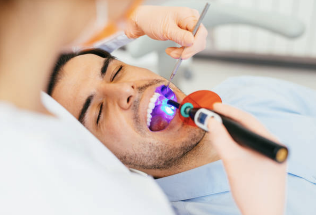 Root Canals in London - #1 Endodontists in London